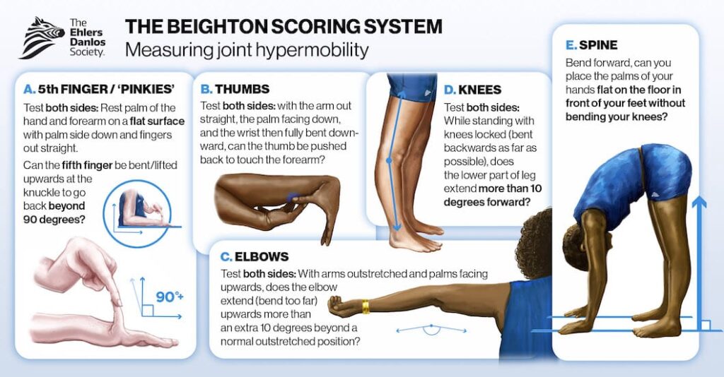 ハイパーモビリティかも？！ - ブリュッセルからボンジュール